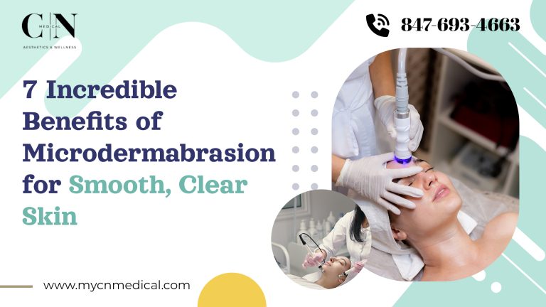 7 Incredible Benefits of Microdermabrasion for Smooth, Clear Skin - CN Medical Aesthetics & Wellness