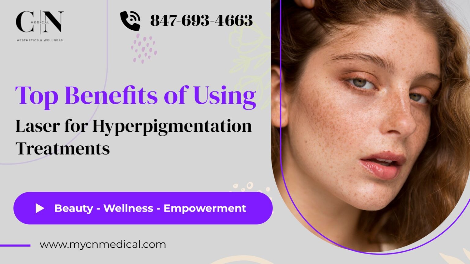 Laser for Hyperpigmentation Benefits | CN Medical Aesthetics